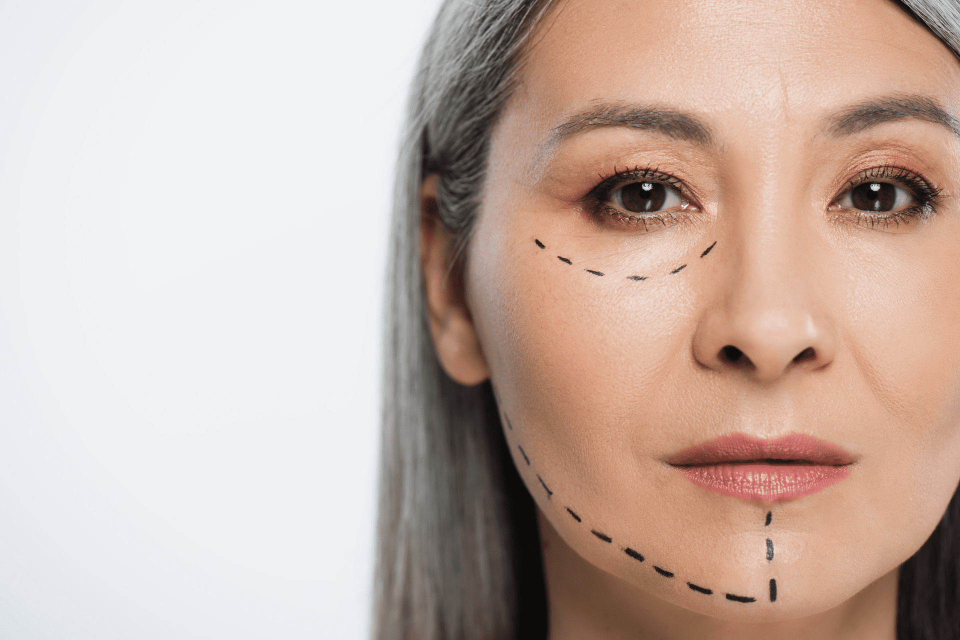Plastic Surgery Guides | Dr. Cheah Plastic Surgery